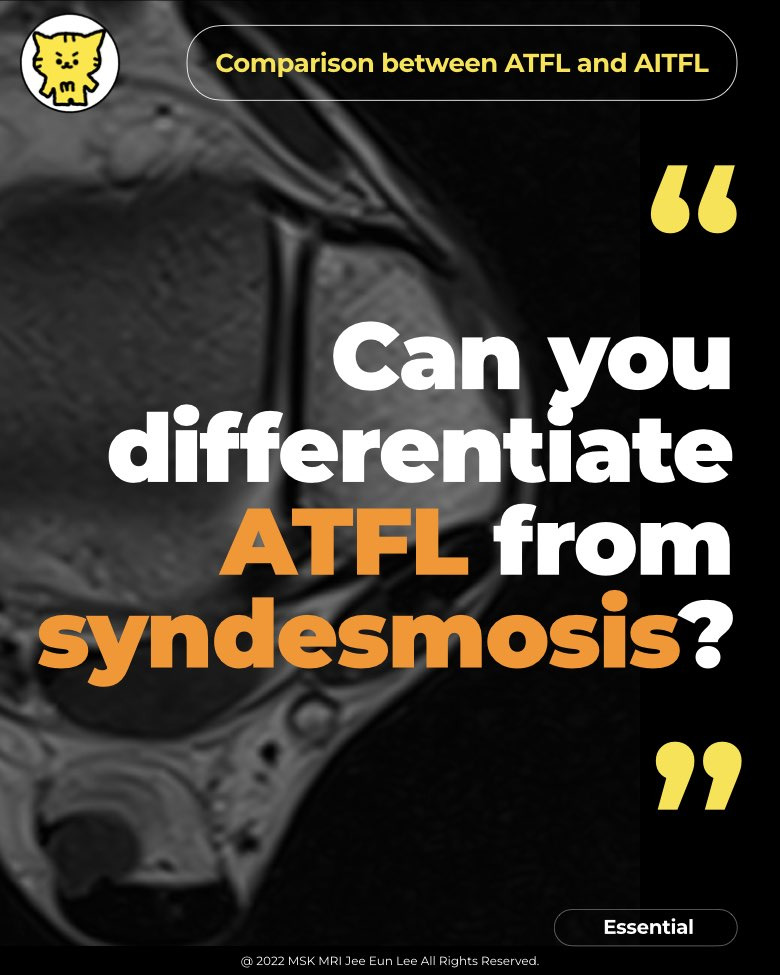 [Essential] Comparison Between ATFL and AITFL: Key Insights for Ankle ...