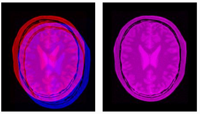 [SimpleITK] Python으로 medical image processing하기 - (2) Registration 1