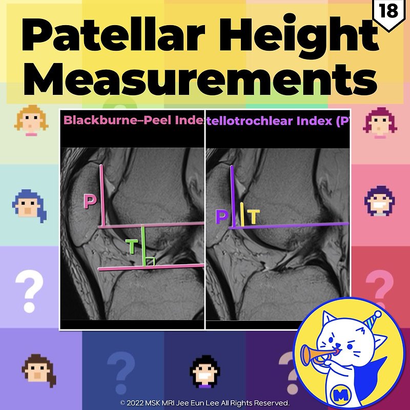 (Fig 4-A.18) Patellar Height Measurements: Part 2