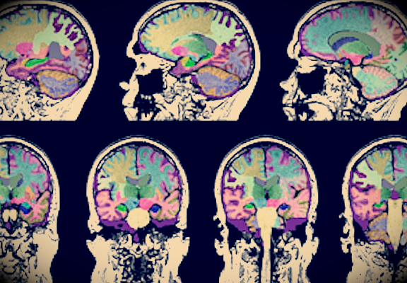MRI로 '머리에 뜬 글'을 읽을 수 있는 AI가 등장/ 막는 방법도 검증.