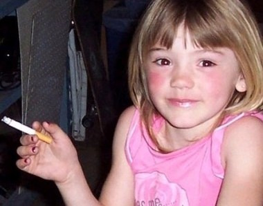 하이랜더 증후군(Highlander Syndrome)-늙지않는 병