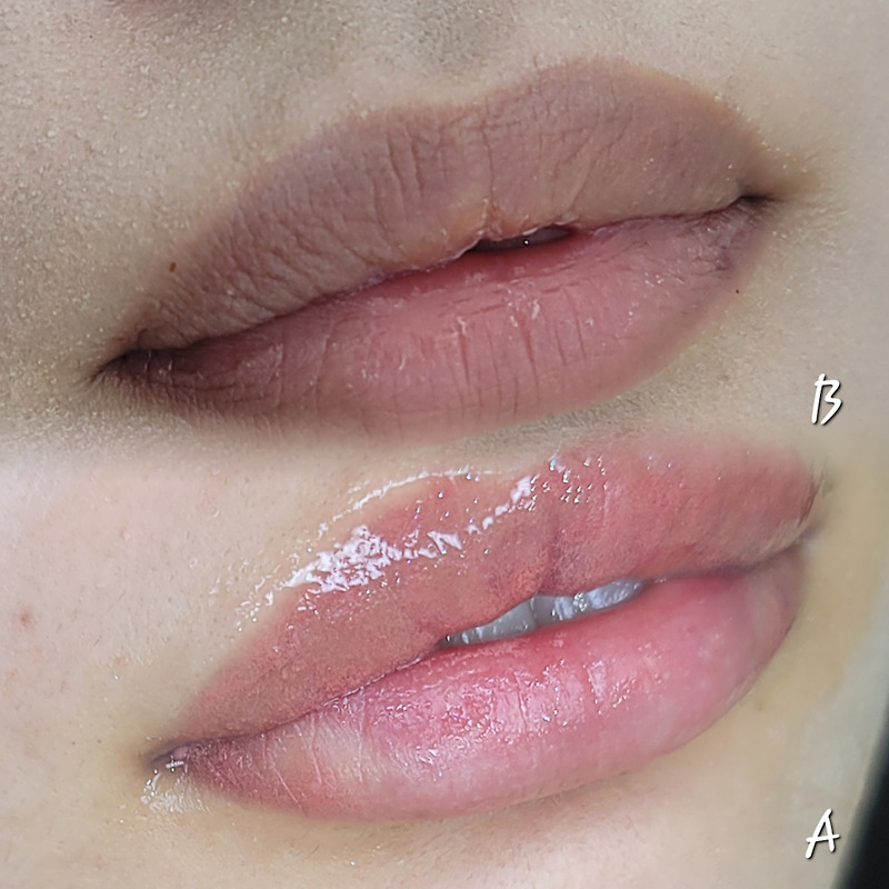 브라운 계열 다크립 입술 문신 시술 전후