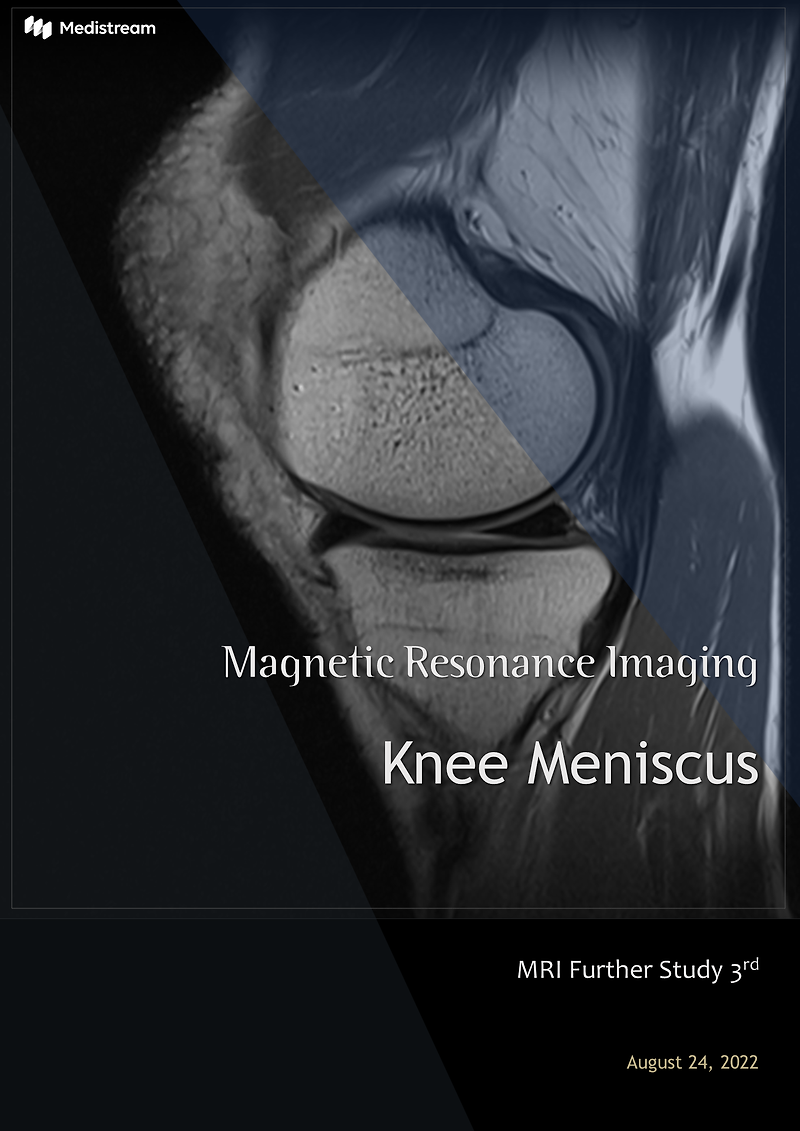 Knee Meniscus. MRI. Advanced Program 침구영상의학