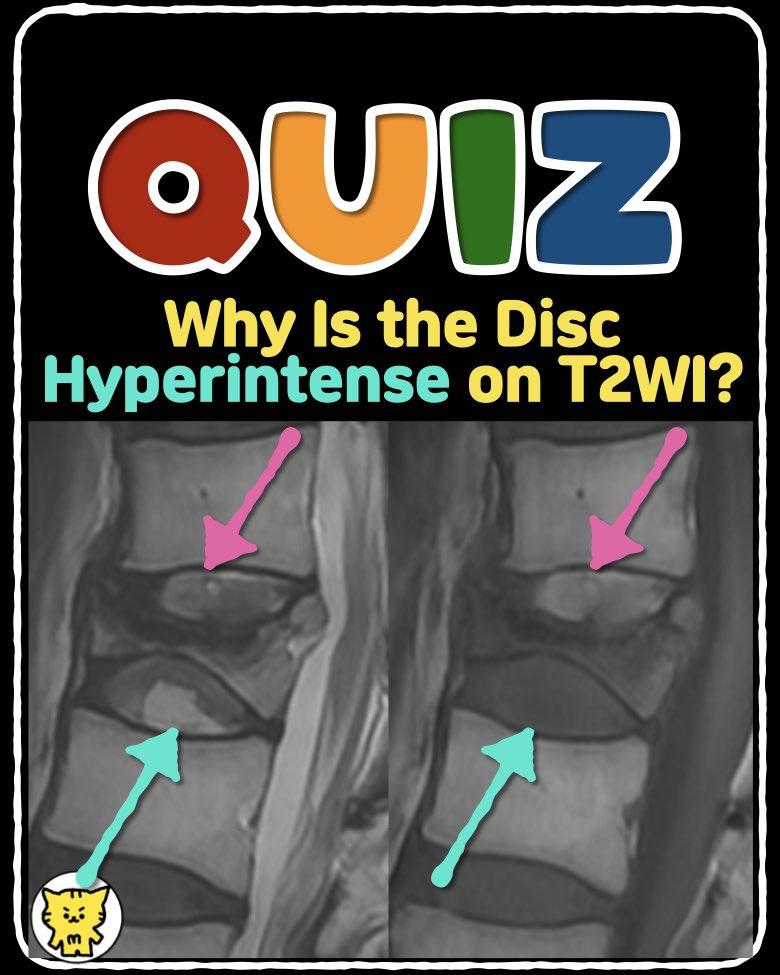 📌 For a patient with an acute compression fracture, why is the disc ...