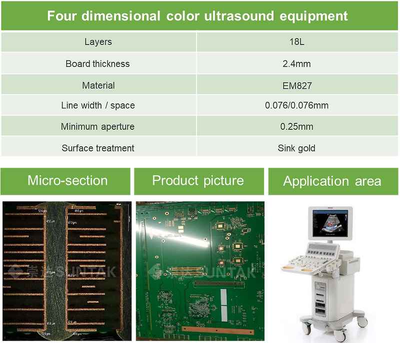 Four dimensional color ultrasound equipment