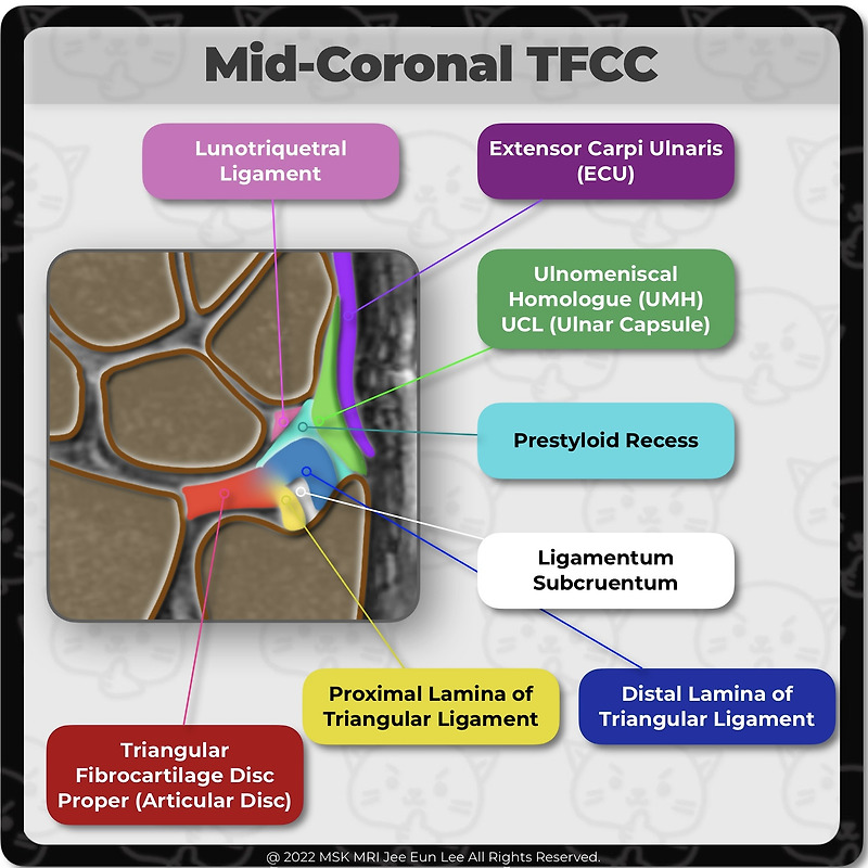 [Anatomy_14] Triangular fibrocartilage complex (TFCC), wrist MRI