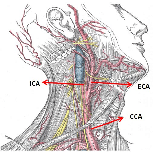 TCD 검사방법 중 경목 측정법(CCA, ICA, ECA 측정방법과 주의점)