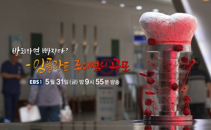 (EBS1 명의) 2024.5.31. 제 870회 〈방치하면 빠진다? 공포의 임플란트 주위염〉