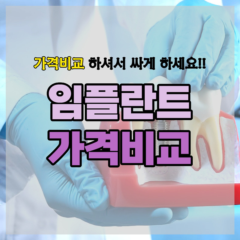 임플란트 가격비교 사이트 싸이트 전국 가장 싼 곳 이벤트 알아보기