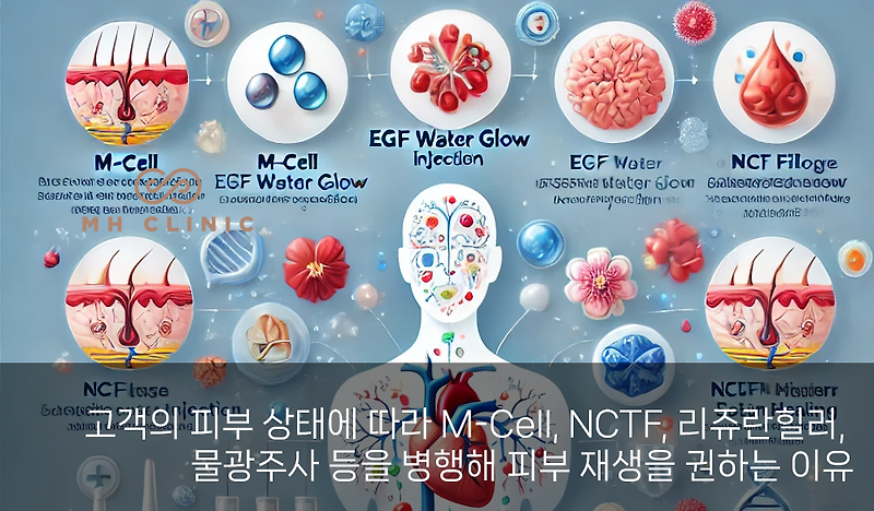 피부 재생, 맞춤형 계획이 핵심입니다.(고객의 피부 상태에 따라 M-Cell, NCTF, 리쥬란힐러, EGF물광주사 등을 병행해 ...