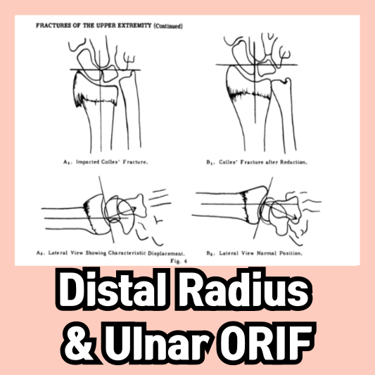 distal Radius & ulnar ORIF 손목골절 수술(OS3)