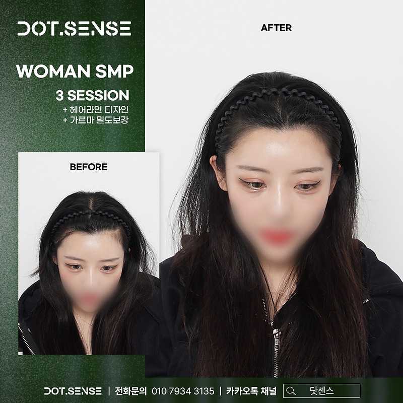 노원헤어라인문신 이런사람들은 절대 하지마세요!