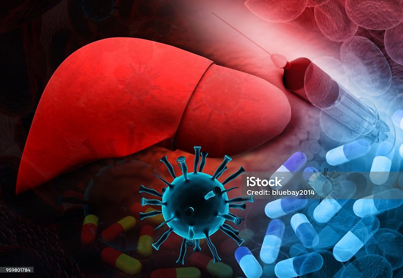 간병보험 - 만성바이러스 간염