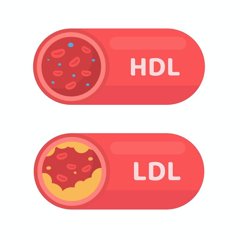HDL 콜레스테롤 수치가 낮다면?