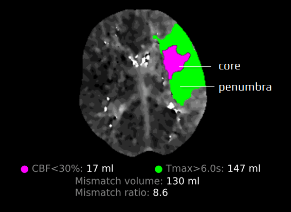 Paper review | A Multimodal Ensemble Deep Learning Model for Functional ...