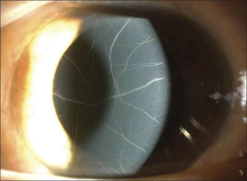 각막 신경, 각막의 신경 분포, 각막 신경 주행 경로(Corneal nerve, Corneal innervation)