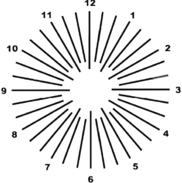난시눈금표(난시표, astigmatic dial)를 이용한 난시의 축과 도수 확인, 자각적(주관적) 난시 굴절검사