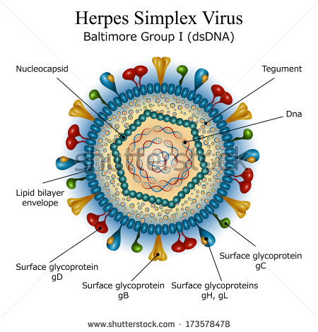 헤르페스 바이러스, 단순포진바이러스(Herpes Simplex Virus, HSV)에 의한 눈감염 : 헤르페스각막염, 단순포진 ...