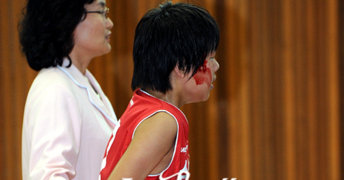 [2009 KBL총재배] 이인규 '아찔한 부상'