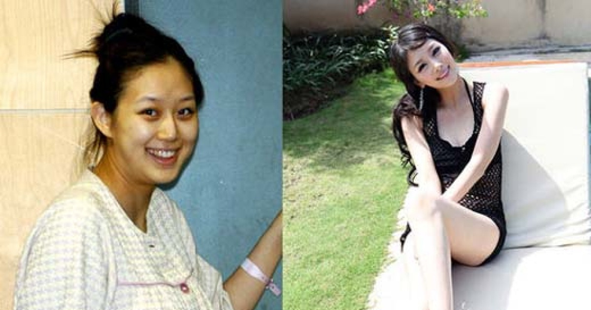 '아줌마 김태희' 경지혜, 78kg 과거사진 공개..국민체조-모유수유 다이어트 30kg 감량!