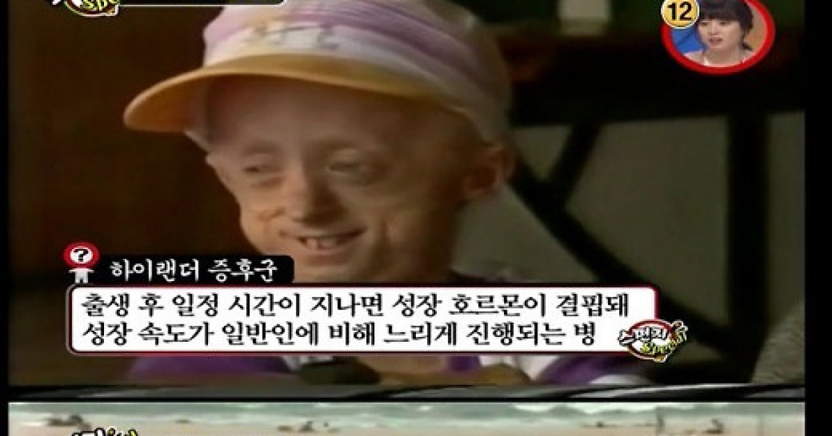 스펀지 늙지 않는 하이랜더 증후군 실제 벤자민 버튼 소개