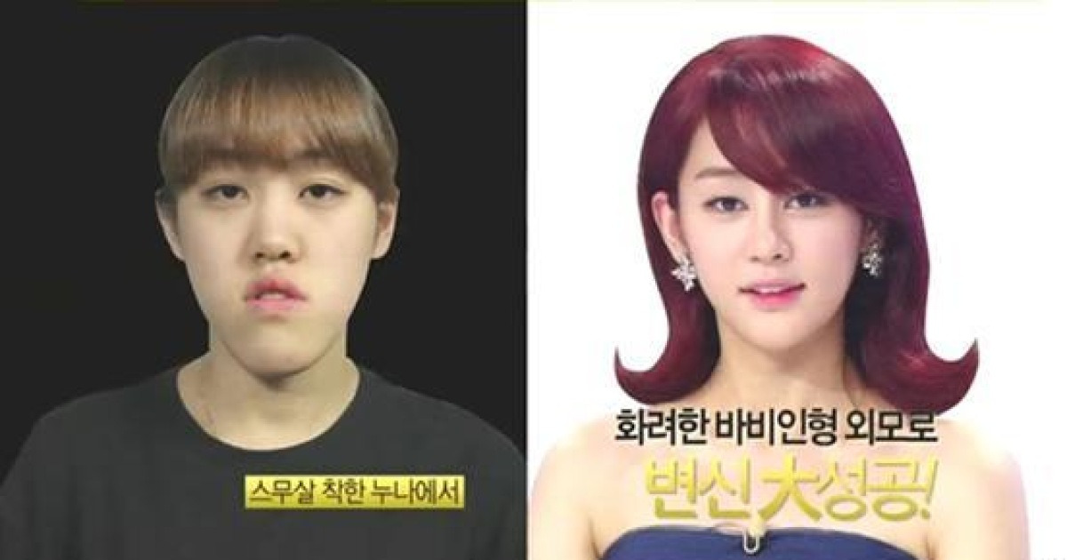 Reality TV hypes plastic surgery craze