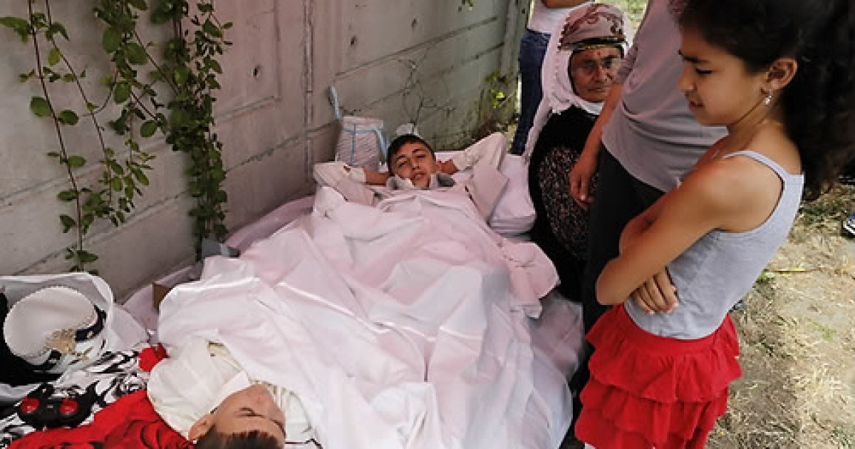 TURKEY FEATURE PACAKGE CIRCUMCISION