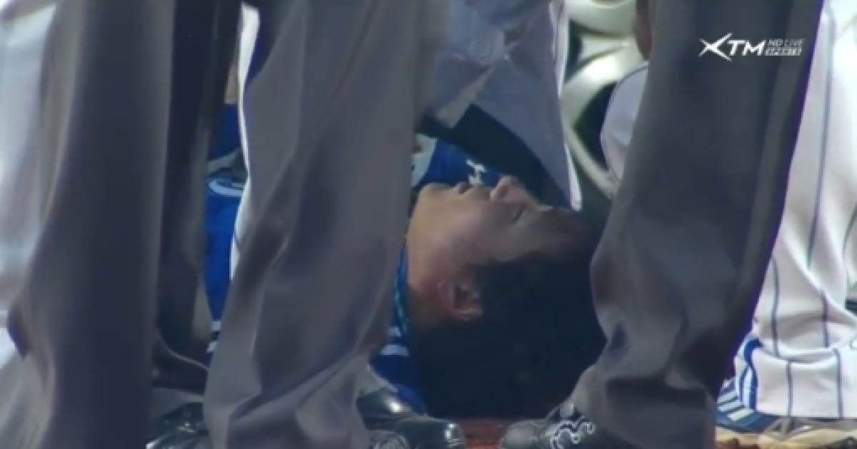 배영섭 부상, 리즈의 151km직구에 머리강타..7회에는 박석민도