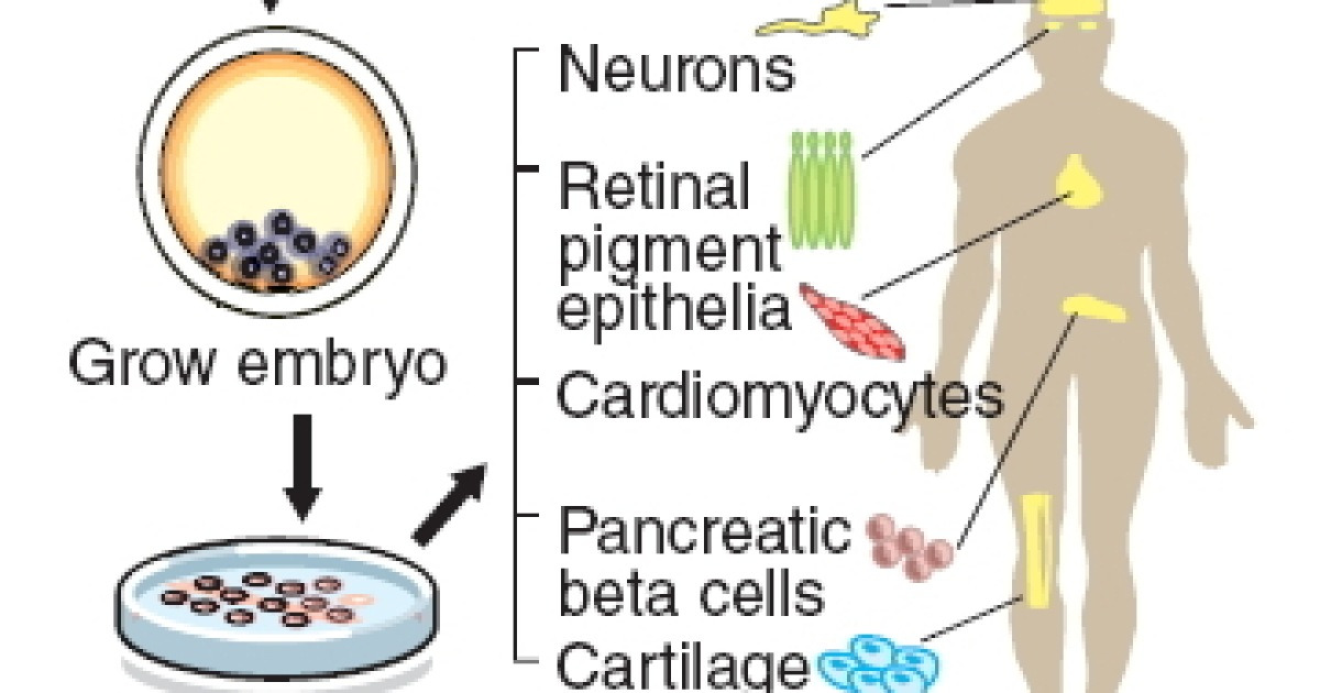 Stem cell research makes headway