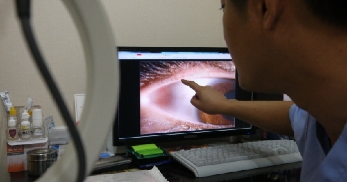 아쿠아ICL, 렌즈삽입술 전 UBM검사 진행되는지 확인해야