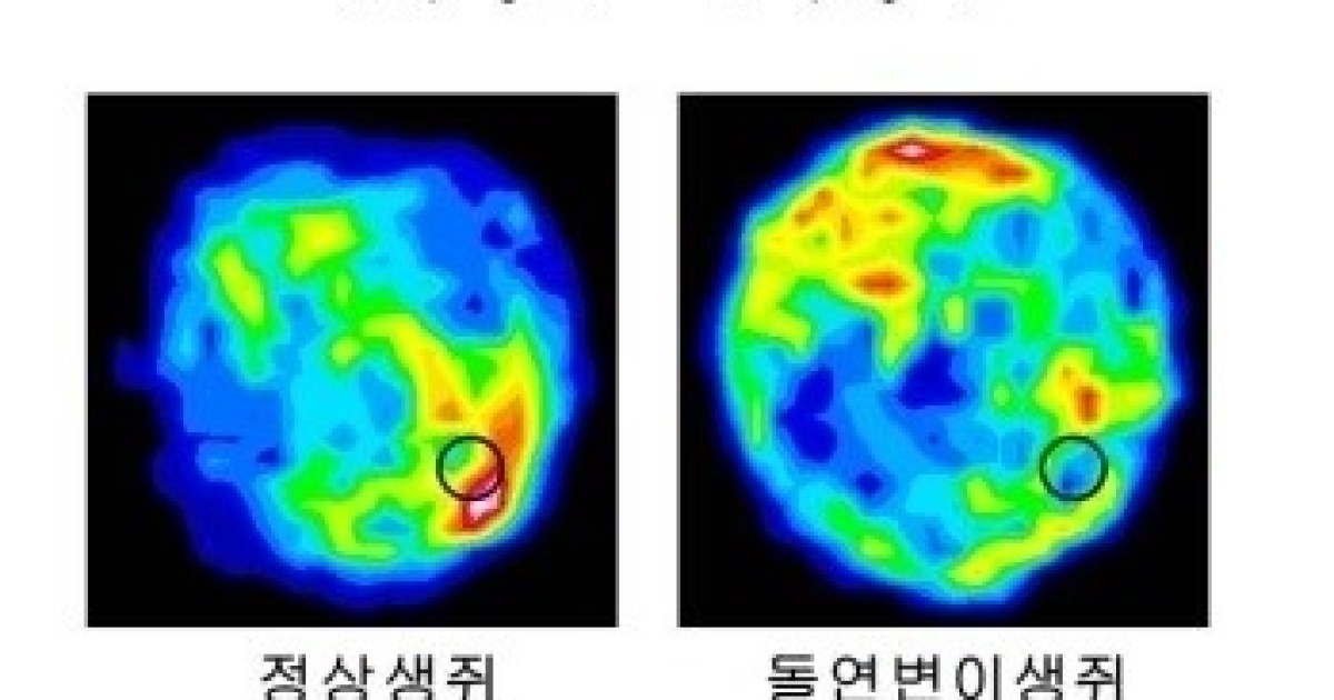 '누난 증후군' 원인 규명..누리꾼 "기억력 높아지나"