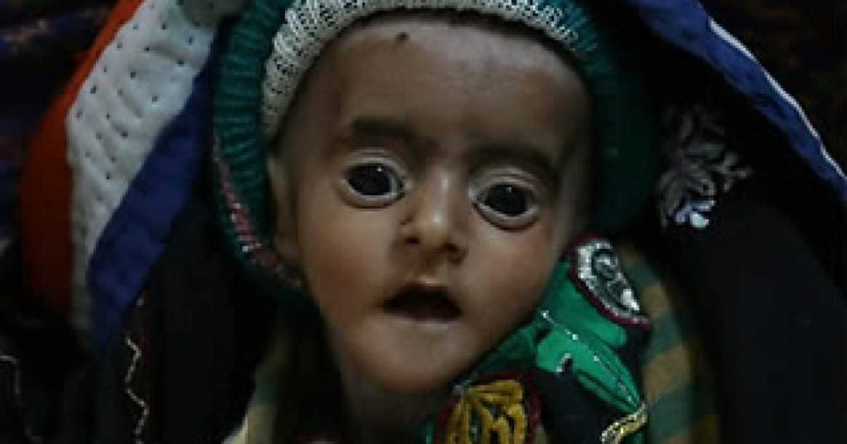 PAKISTAN FAMINE CRISIS