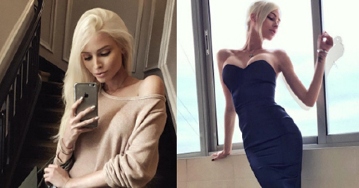 "45kg도 안 된다고?" 러시아 톱모델, 거식증 의심