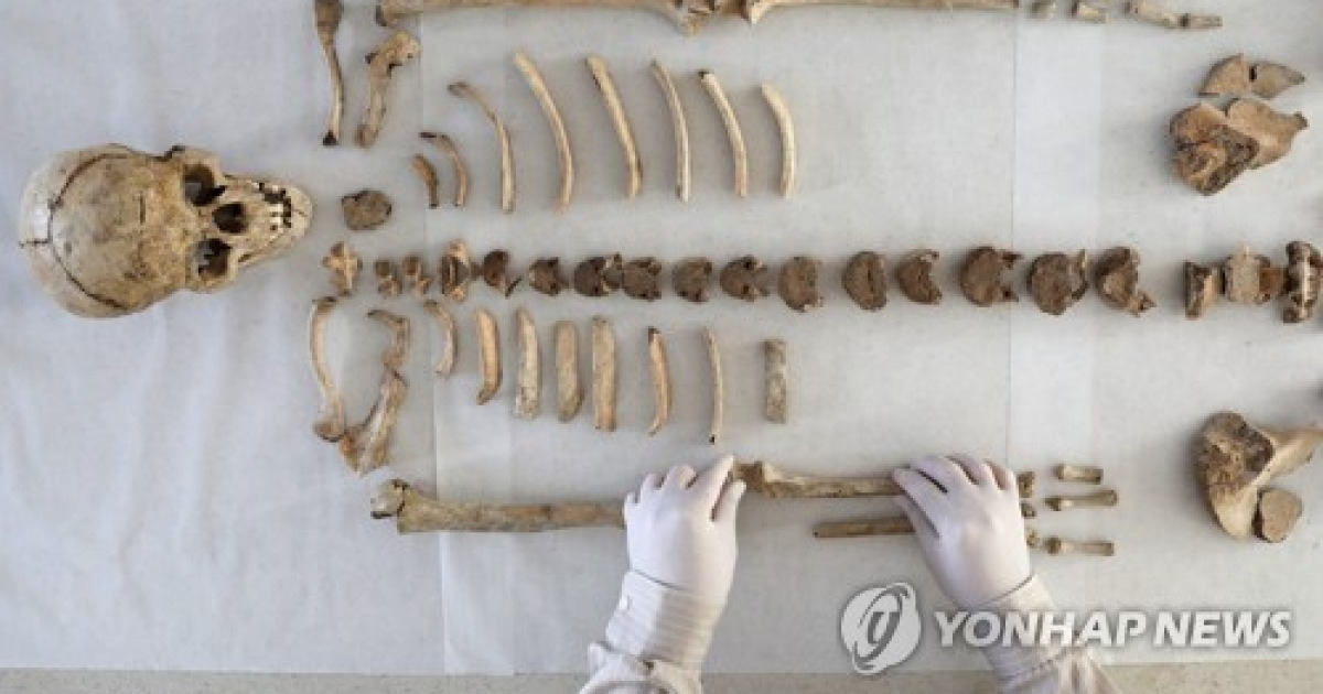 HUNGARY OLDEST CASE OF LEPROSY