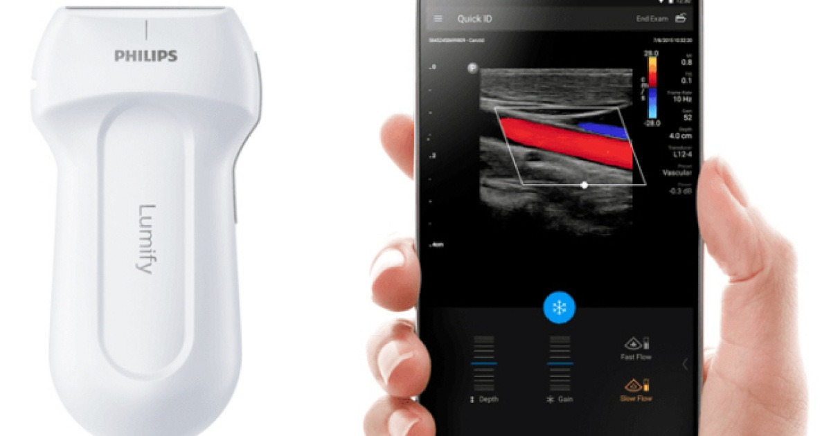 Philips' portable ultrasound machine for smart devices arrives in Korea