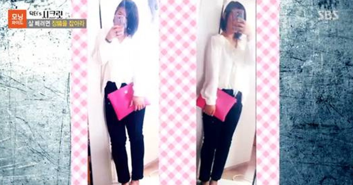 '130kg→70kg' 모유유산균, '뚱보균' 잡는 다이어트 비법