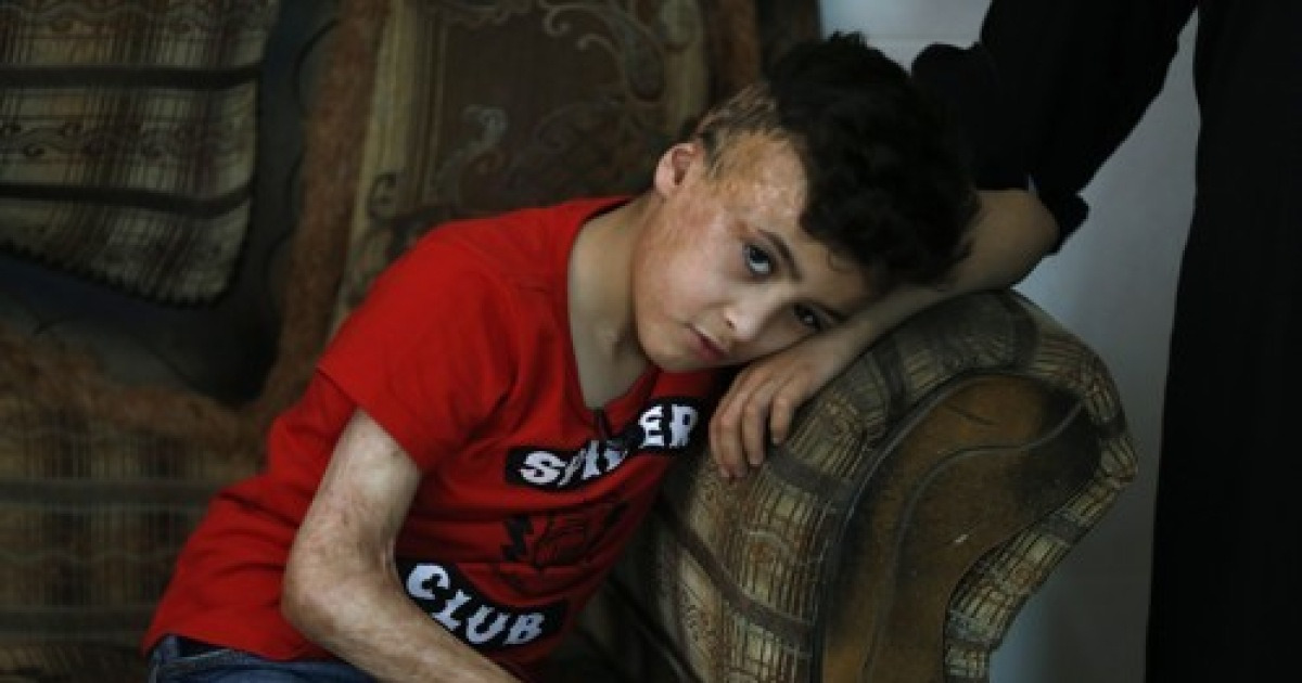 MIDEAST CONFLICT PALESTINIANS ISRAEL DUMA ARSON