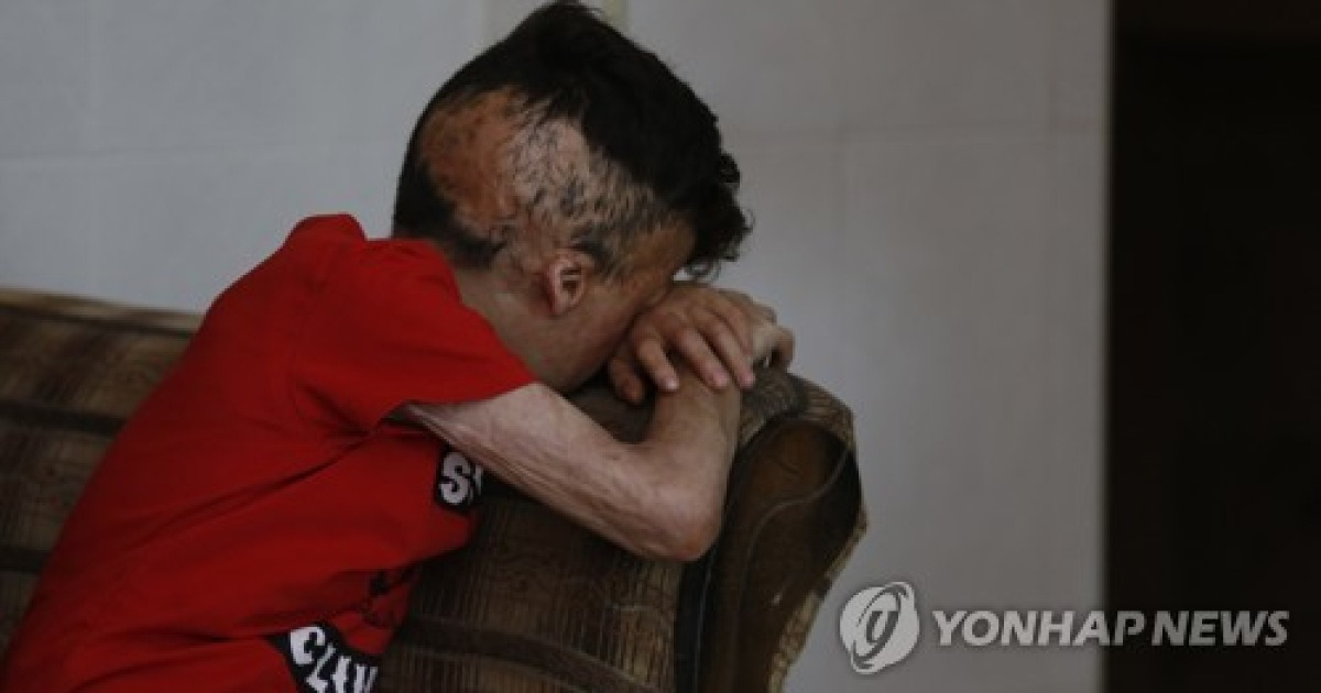 MIDEAST CONFLICT PALESTINIANS ISRAEL DUMA ARSON