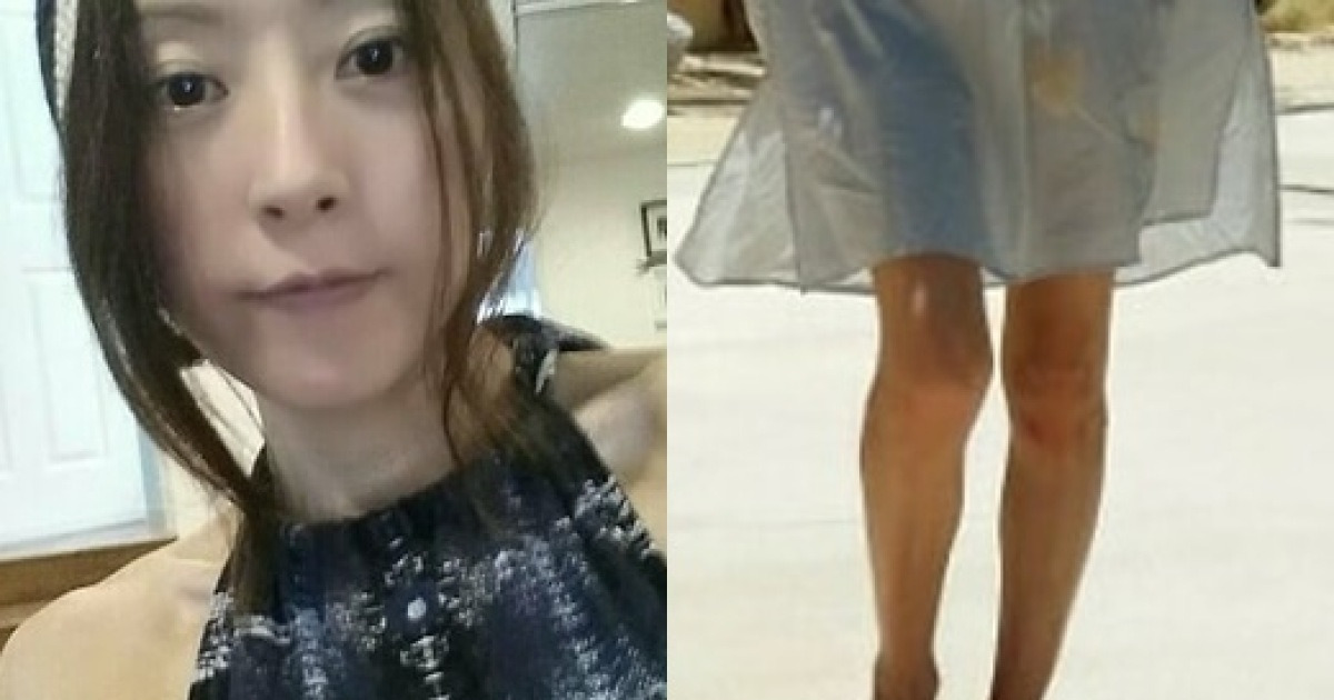 서정희, 뼈만 남은 다리 사진 올리며.."37kg 때의 나, 44kg으로 살찐 지금이 좋다"
