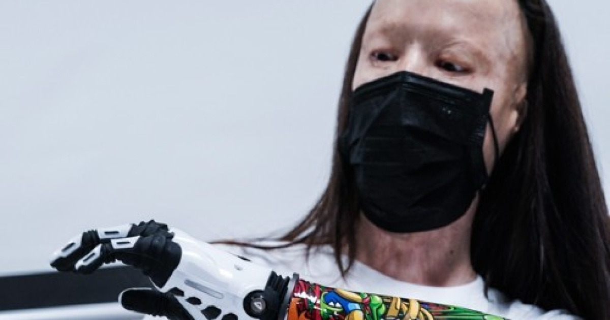 ITALY TECHNOLOGY BIONIC PEOPLE