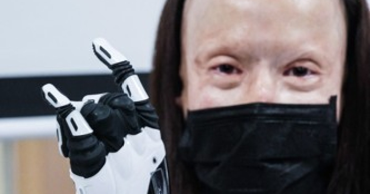 ITALY TECHNOLOGY BIONIC PEOPLE