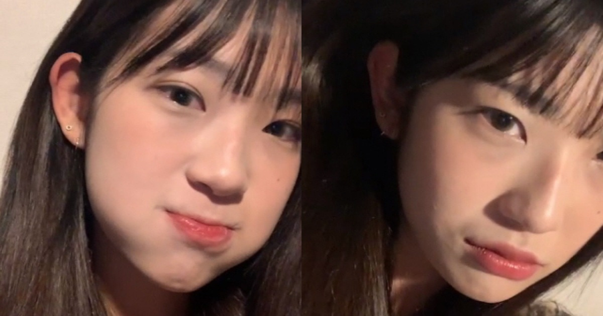 최준희 "키 170cm·96kg→52kg까지 감량"..입술 필러 시술 고백