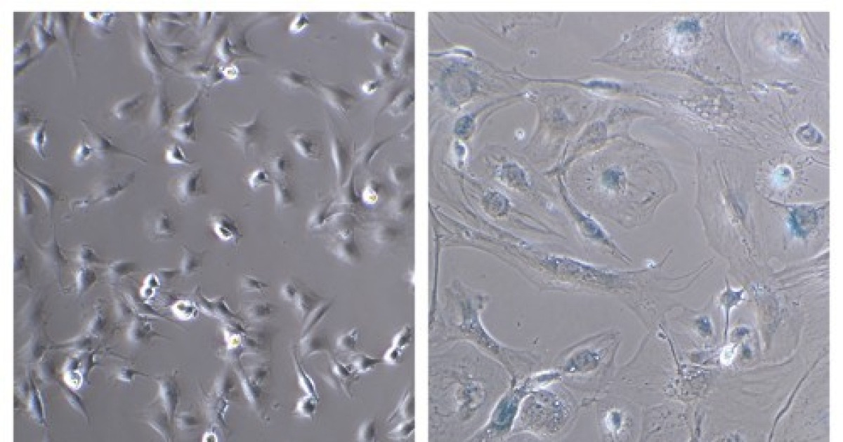 Zombie Cells-Healthy Aging