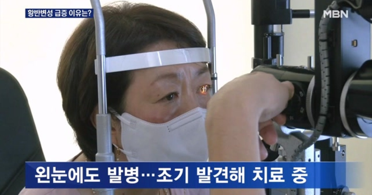 실명 초래하는 황반변성 환자 급증 장년부터 정기검사 필요