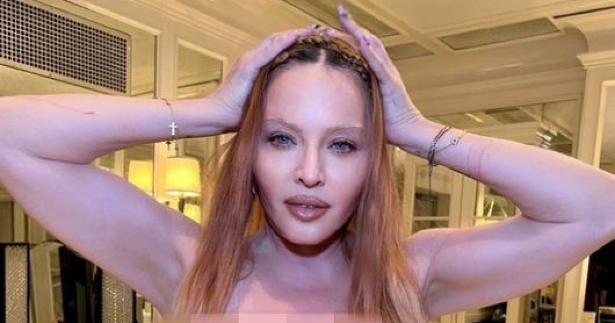 '성형 부작용' 마돈나, 인조인간 급..브리트니 넘는 충격 사진 [Oh!llywood]