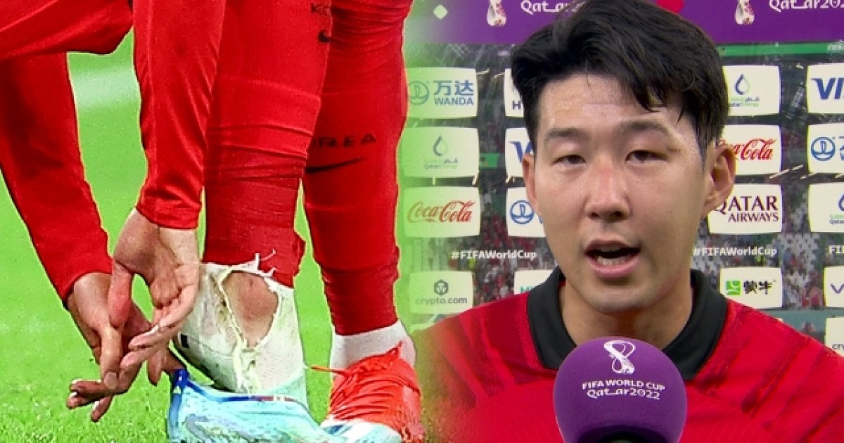 마스크 쓰고 발이 밟혀도…손흥민 '혼의 축구' BBC 선정 MVP