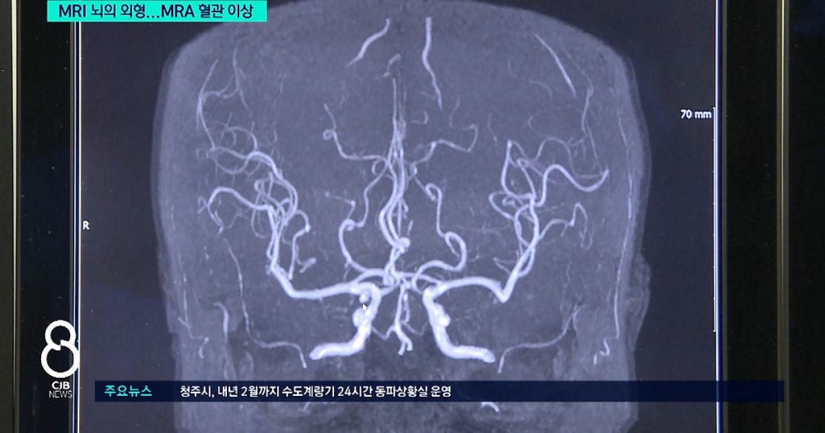 건강검진에서 MRI 받을까, MRA 받을까..차이는?