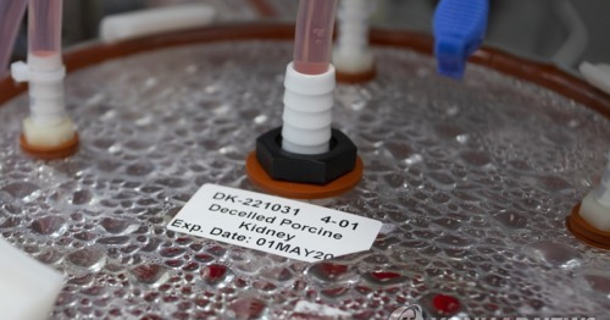 CORRECTION Bioengineered Organs