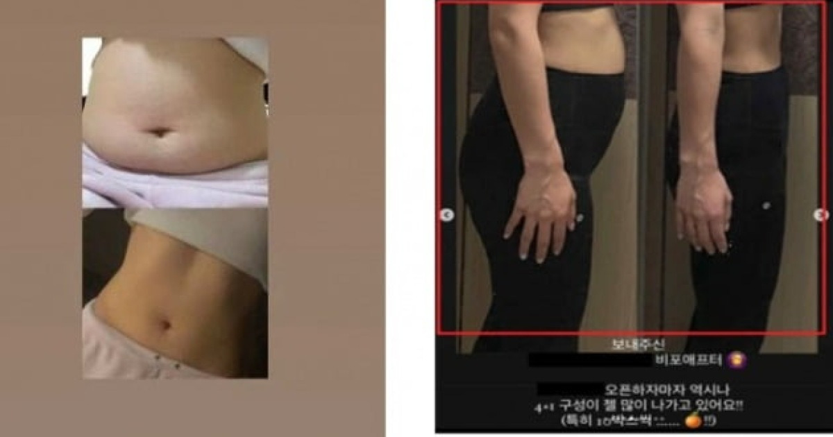 "언니, 벌써 3kg 빠졌어요"…SNS 광고 거짓말이었다