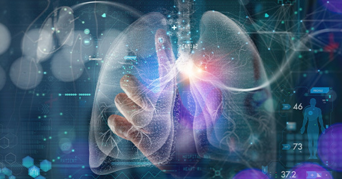 조기 진단 중요한 COPD…AI로 위험 환자 찾아낸다